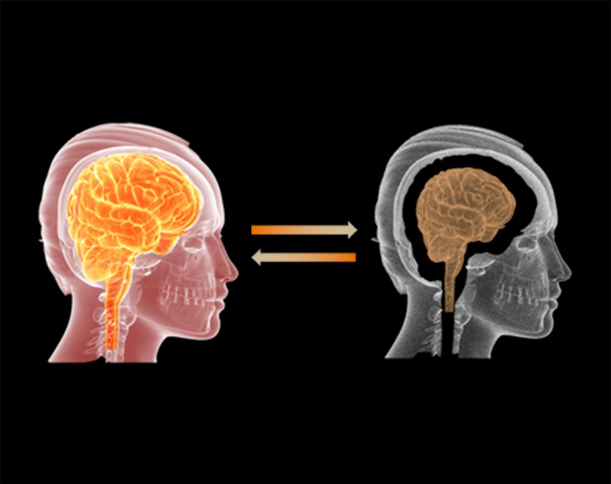 Stanford Brain Rejuvenation Project (Phase 2) | Wu Tsai Neurosciences ...