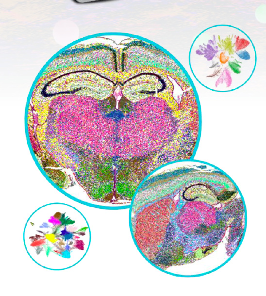 MERSCOPE: Spatially map the brain in health and disease with single ...